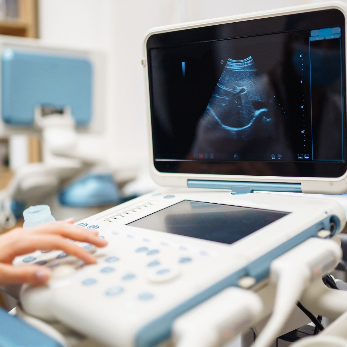 Star Advanced Sonography Center – STAR MRI SCAN CENTRE